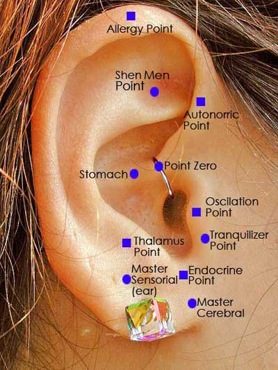 Auricular Therapy