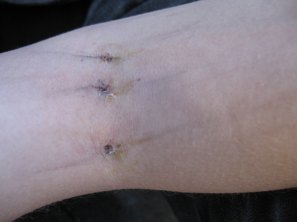 Pathology Cases: October 2012