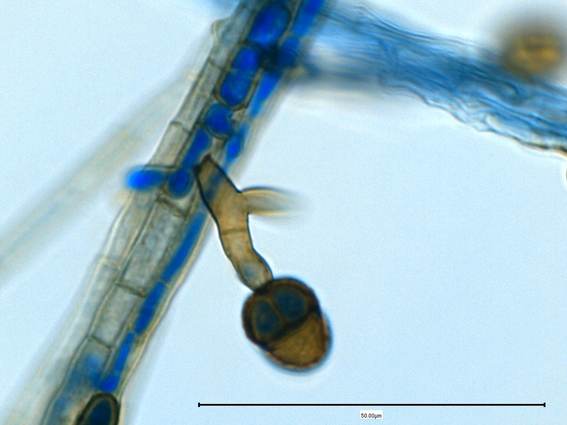 Fun With Microbiology (What's Buggin' You?): Stemphylium species
