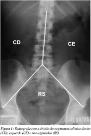 Radiologia para Técnicos: TEMPO DE TRÂNSITO COLÔNICO: