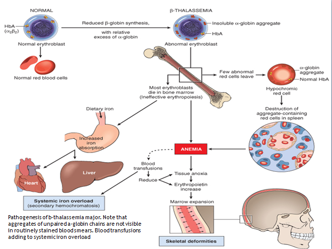 ChyntiaBlog: Talasemia pada Anak