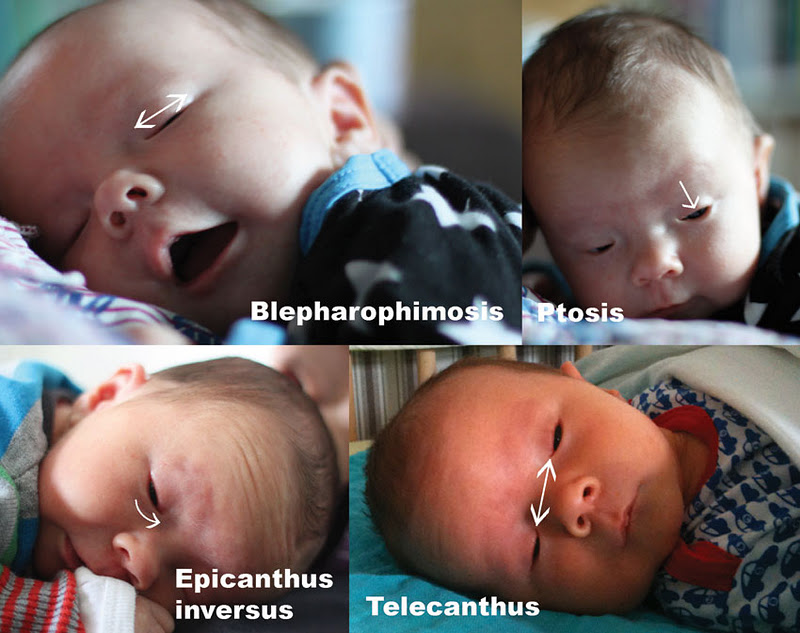 We are a "Berry" Blessed Family: EIGHTEEN Months!!