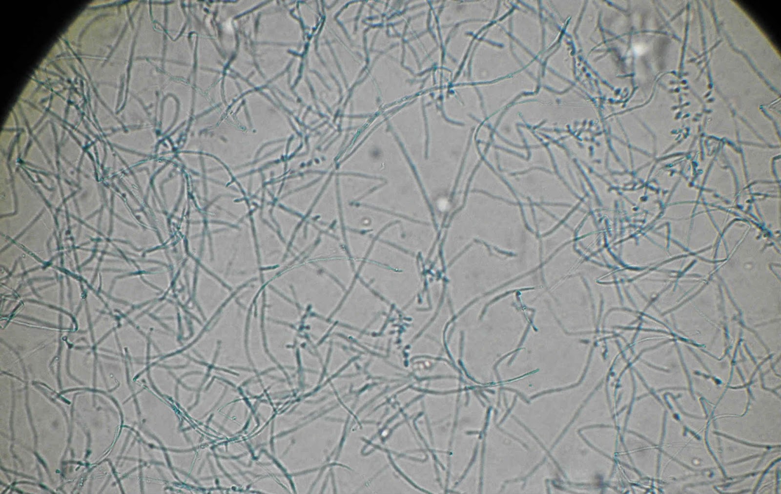 ATLAS MICOLOGIA: TRICHOPHYTON TONSURANS (2)