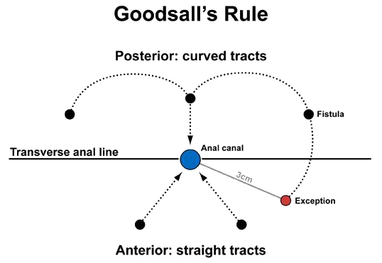 Goodsall's rule | Medchrome Images