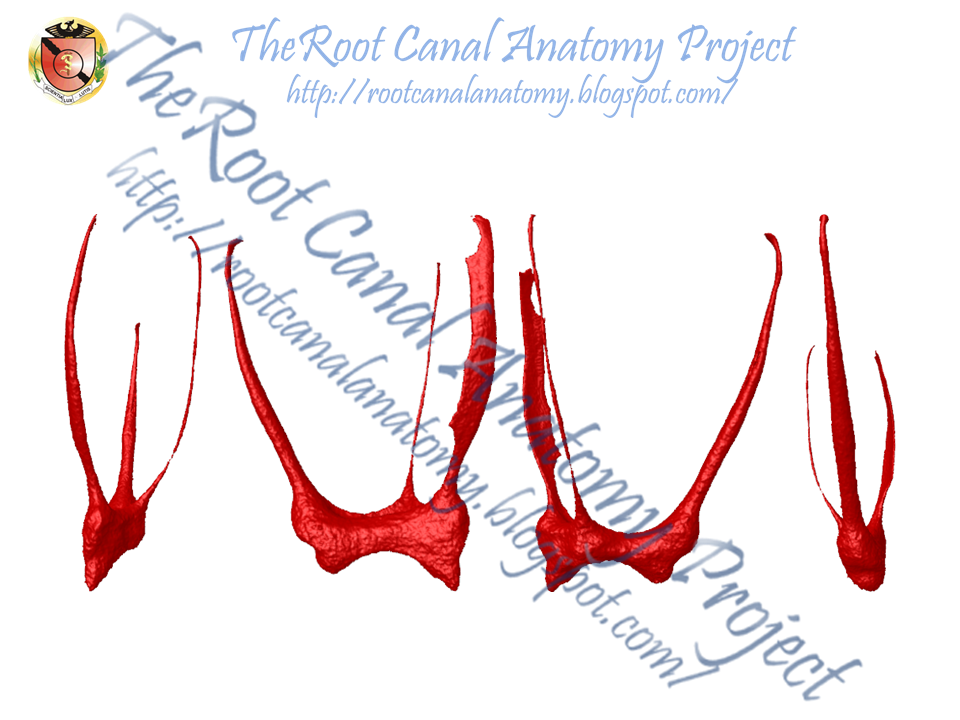 The Root Canal Anatomy Project: Maxillary First Molar