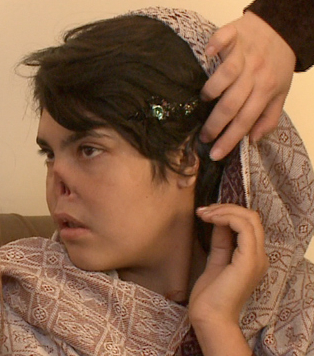 Live facebook: Photograph of Bibi Aisha, an 18-year-old woman whose ...