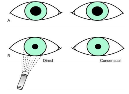 Refleks Nedir? Refleks Çeşitleri Nelerdir ve Refleks Muayenesi Nasıl ...