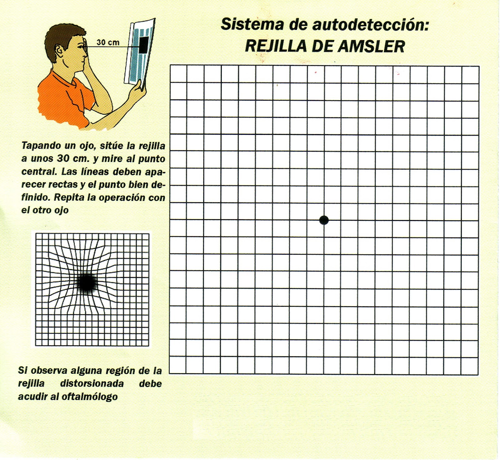 Educación Física en la Red: La degeneración macular en las personas ...