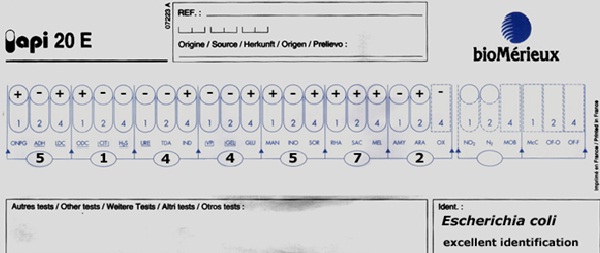 Identification des bactéries par API20E - كيمياء المعرفة