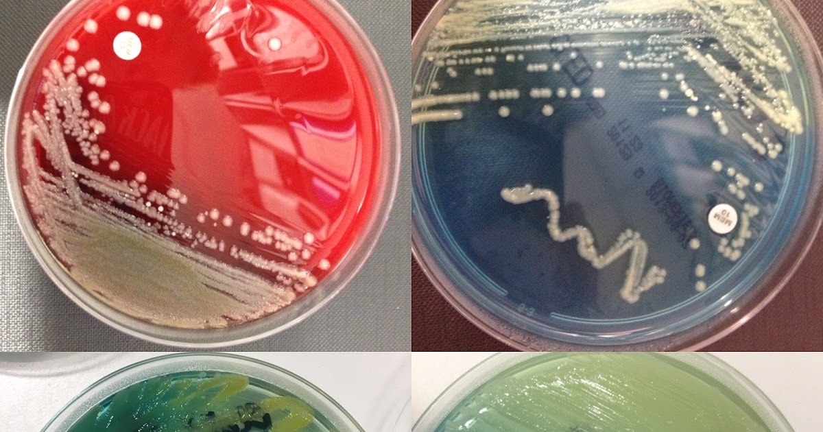 Welcome.....Virtual diary of a mature student mom!: Bacteria baby ...