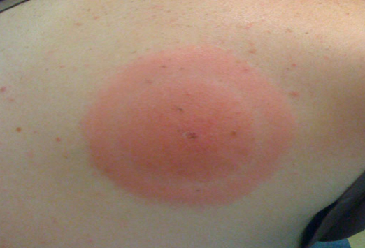 World's Tragic In Medlife,.....You May Know Or Not: Strange Skin ...