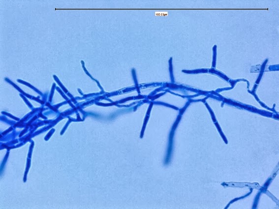 Fun With Microbiology (What's Buggin' You?): Trichophyton terrestre