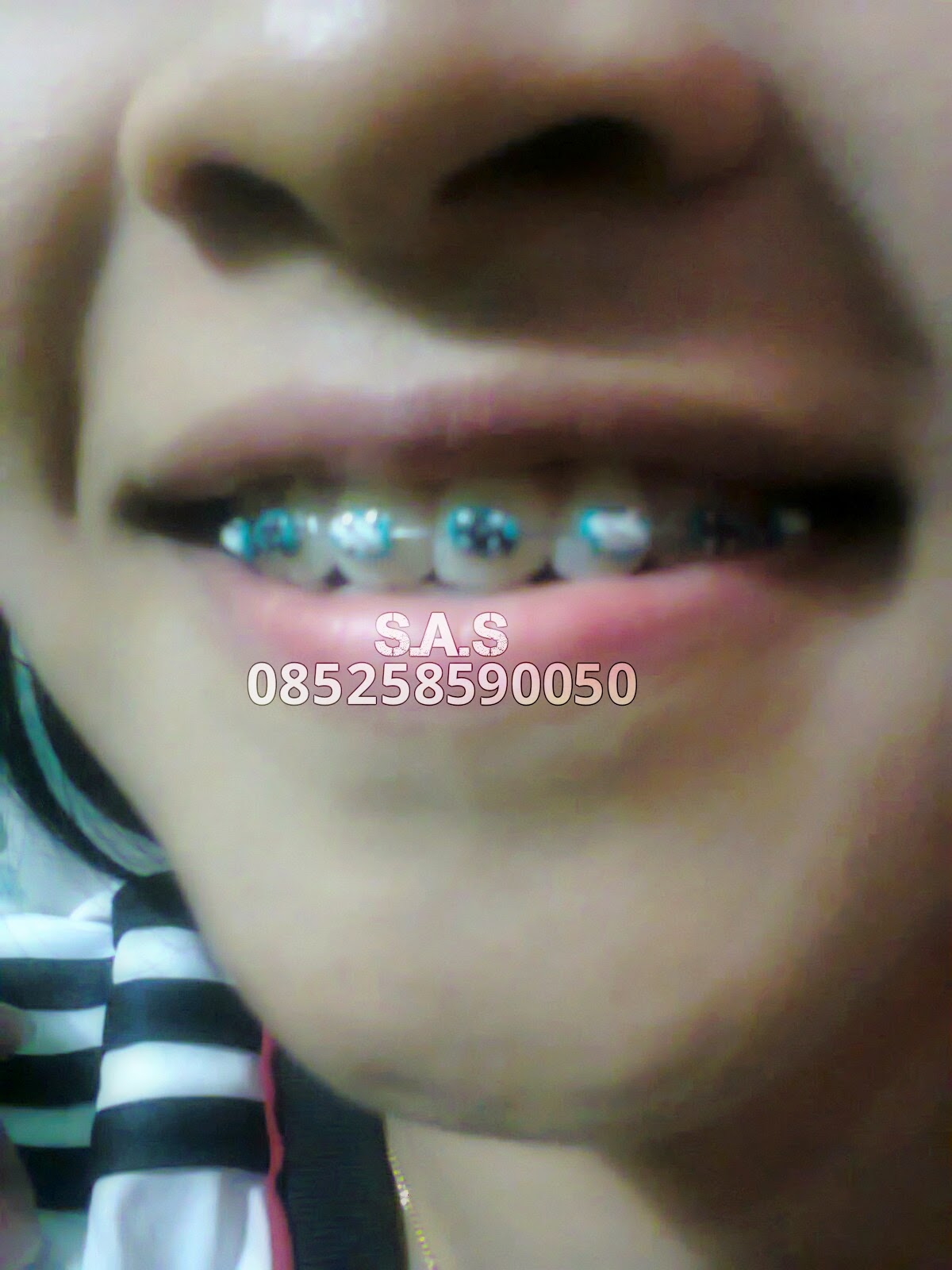 S.A.S - AHLI GIGI KOTA PATI, Jateng & KOTA JEMBER, Jatim: Si Cantik dan ...