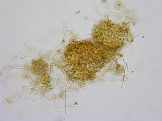 Fun With Microbiology (What's Buggin' You?): Eurotium herbariorum ...