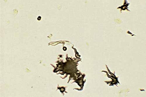 Atlas of Crystals found in alkaline urine | Free Medical Atlas