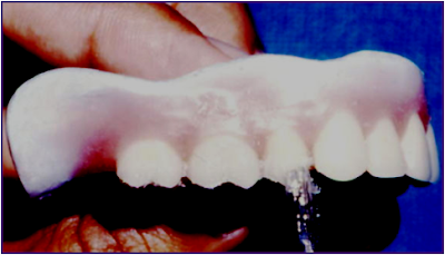Dentistry and Medicine: Concept of Neutral Zone