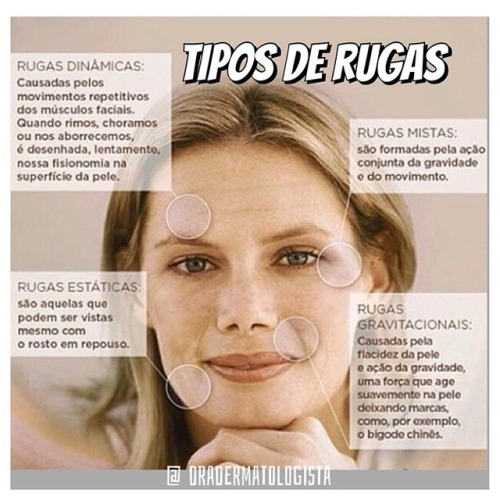 Então, vamos lá!!! LIVE LIFE ️ VIVER A VIDA Fátima Camargo : TIPOS DE RUGAS