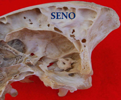 MVZ universidad de la amazonia: HUESOS NEUMÁTICOS