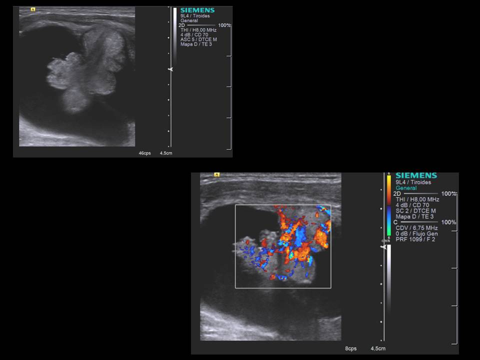 Casos de radiología de la Clínica Universidad de Navarra: Caso 268