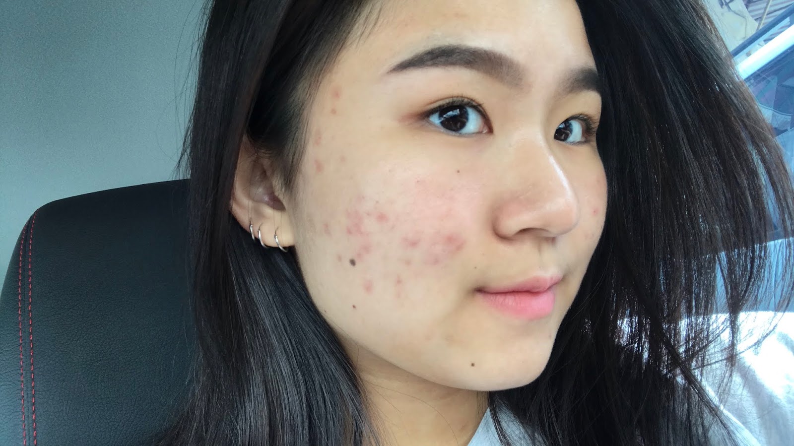 first facial experience @ One Doc Medical - Nourish to Flourish.