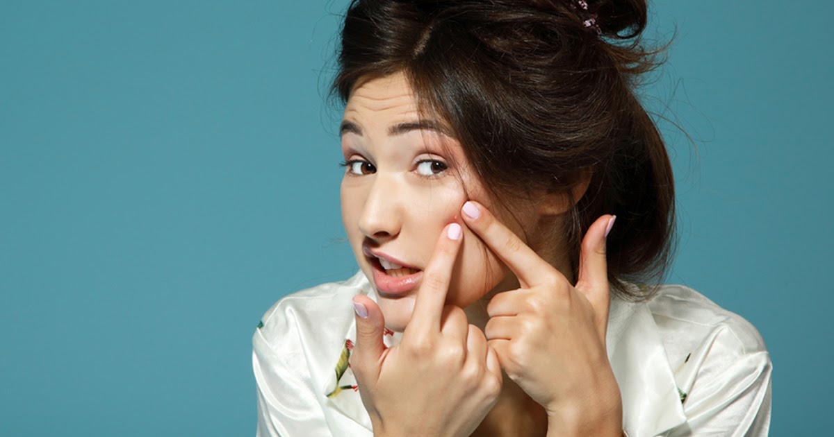 Best Tips To Prevent Acne And Pimples Naturally - Tashiara