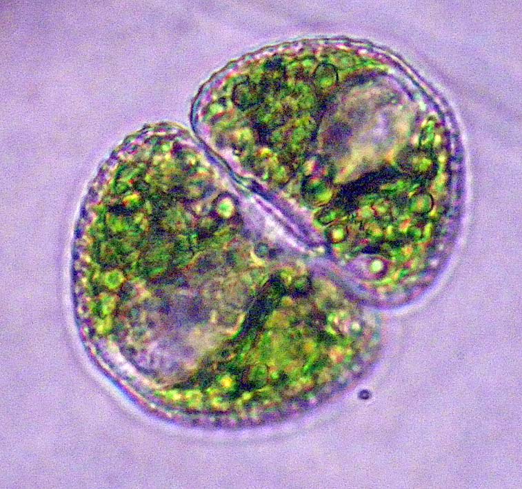 Beyond the Human Eye: Life in a few Drops of Water: Desmids