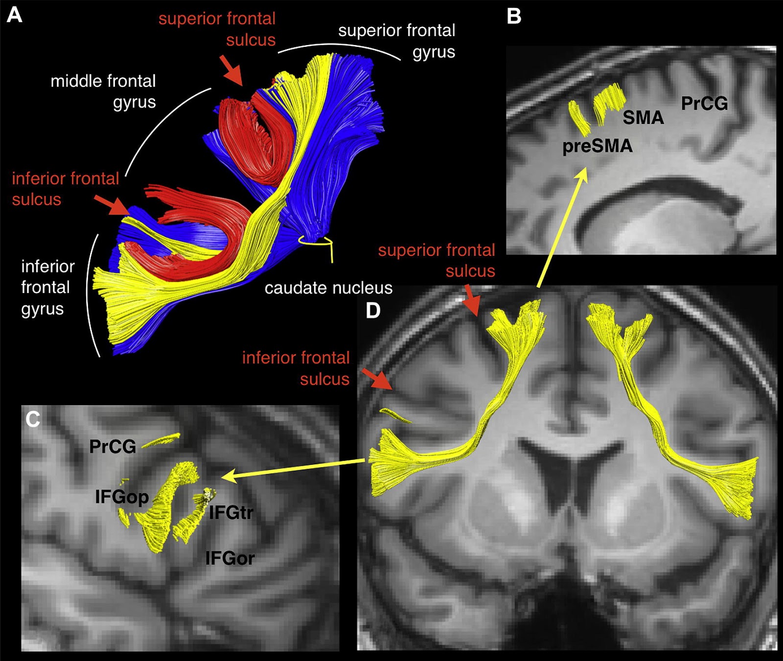 The Neurocomplimenter: A New Slant on Frontal Connectivity: the Frontal ...