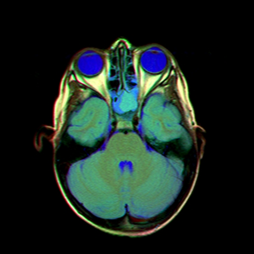 Nevit's blog: Color MRI of the Brain