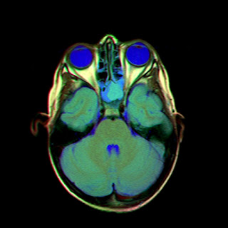 Nevit's blog: Color MRI of the Brain