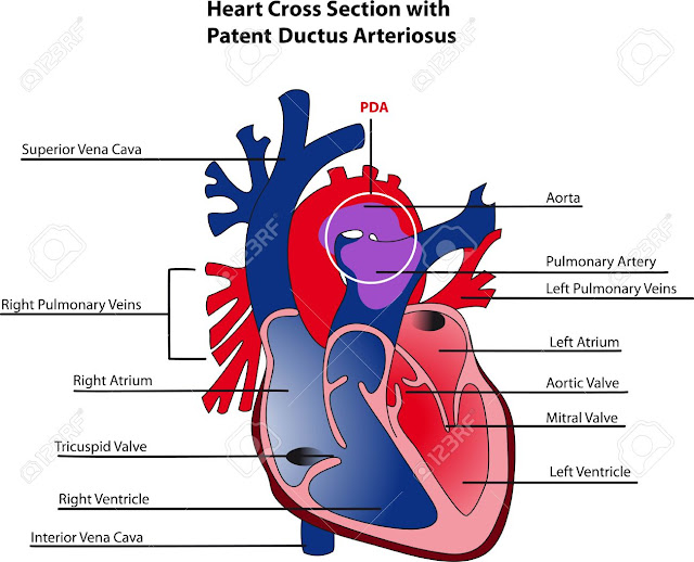 Ductus arteriosus