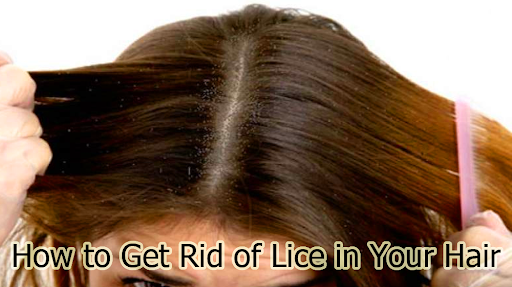 How to Get Rid of Lice in Your Hair