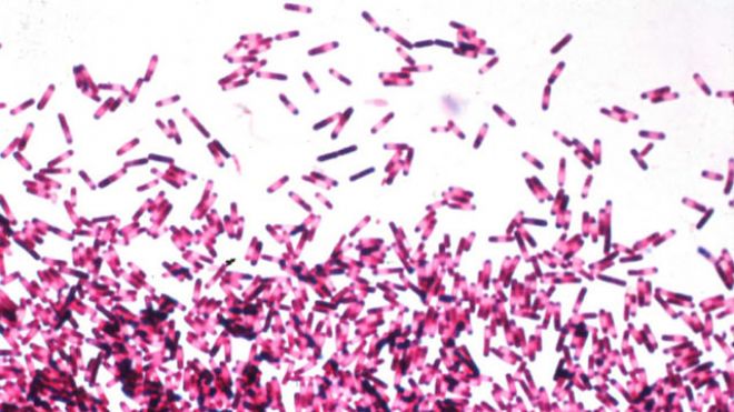 White Wolf : Dog trained to sniff out deadly C. difficile superbug (Video)