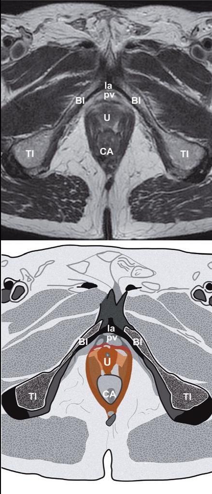 L’approche radio-anatomique de la région périnéale profonde et du ...