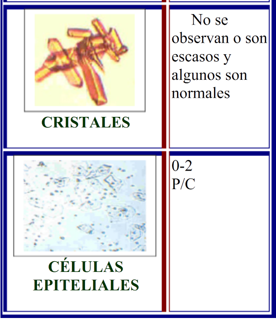Laboratorio Clinico: Examen general de orina ( E.GO.)