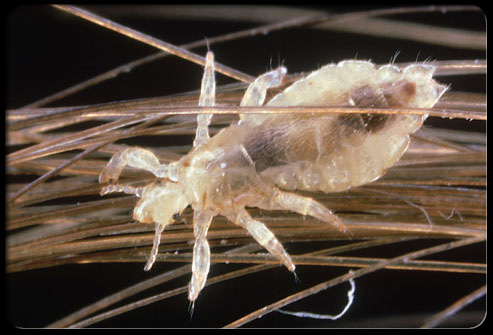BEAUTICIAN TIPS: HAIR LICE