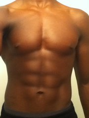 SEMIOLOGIA QUIRURGICA UTESA SANTIAGO: Examen del torax