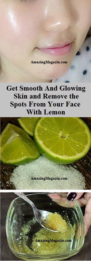 Get Smooth And Glowing Skin and Remove the Spots From Your Face With ...