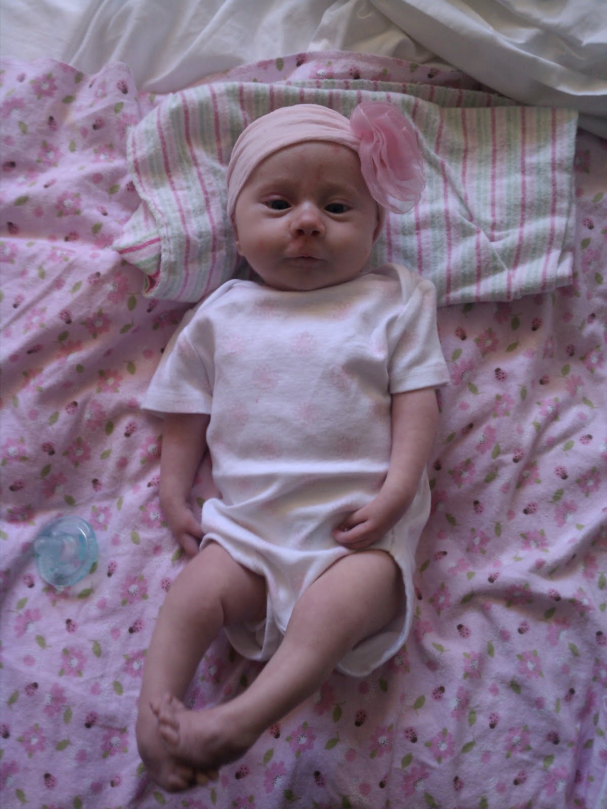 Sweet Analise Rose's Journey with Arthrogryposis, Amyoplasia type: Day ...