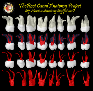 The Root Canal Anatomy Project: Maxillary Second Molar