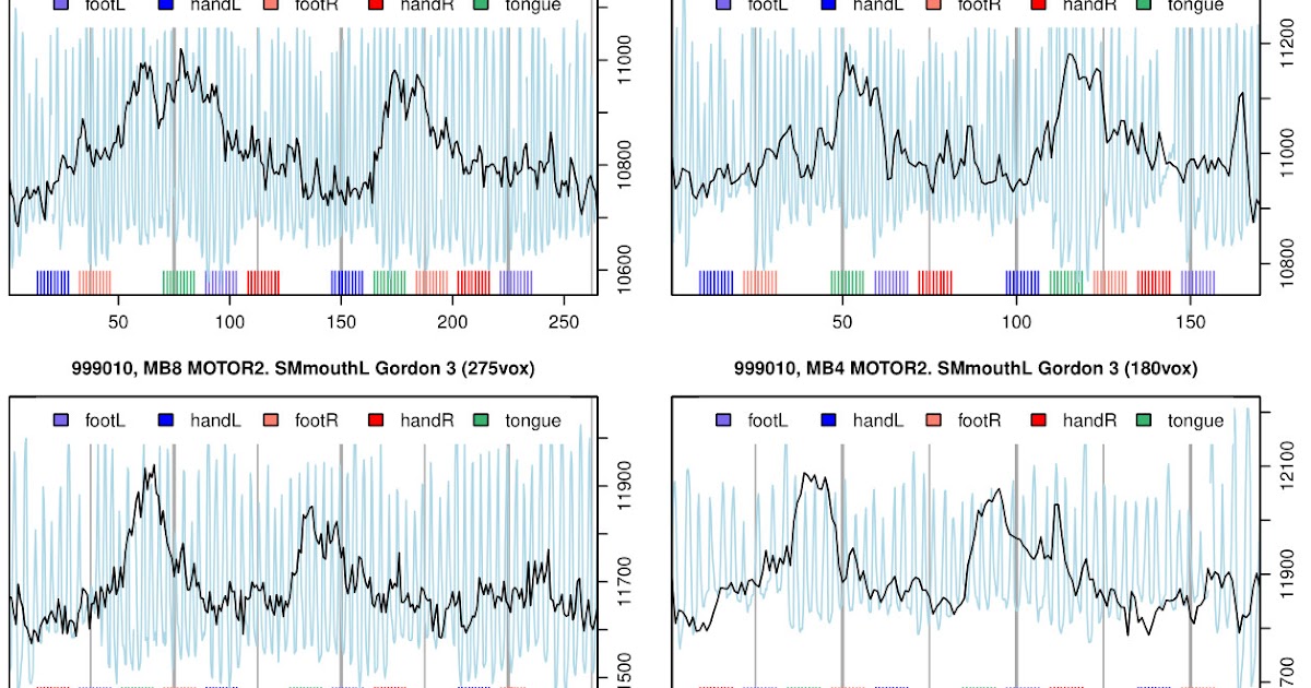 MVPA Meanderings: multiband acquisition sequence testing: timecourses 2