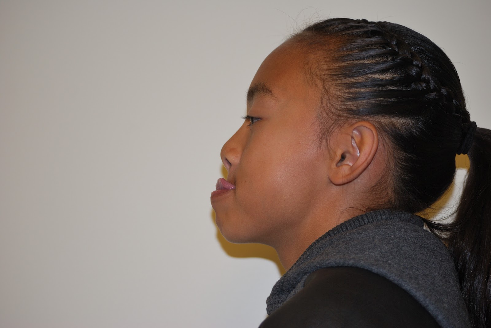 Myofunctional Therapy: OroFacial Muscle Re-Education