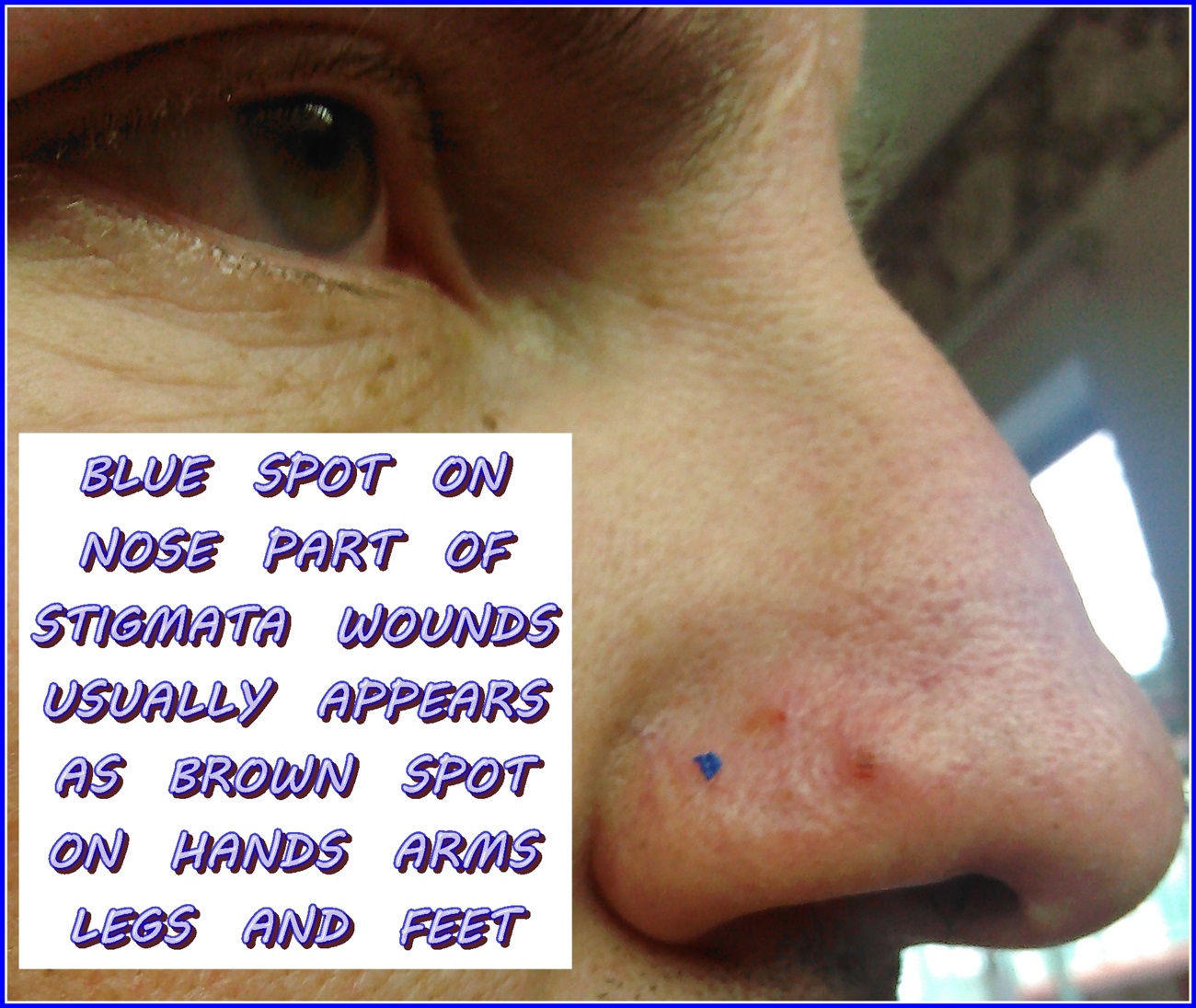 STIGMATA EYES AND WOUNDS