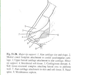 Shield Graft: Nasal tip complications and optional operative fixes