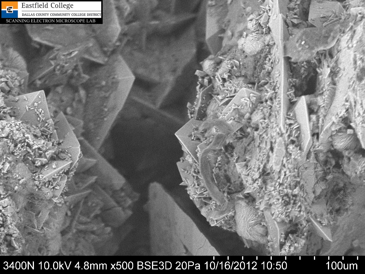 Scanning Electron Microscope Blog: A Kidney Stone - OUCH!!