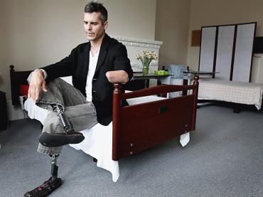 Media dis&dat: San Francisco doctor who is triple amputee finds his ...