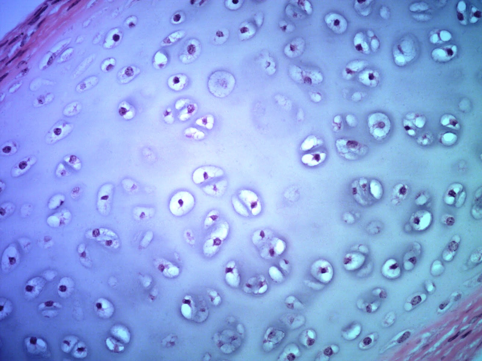 Histologia dos Tecidos: Cartilagem hialina