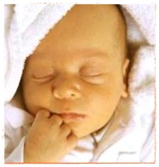 Sănătatea din tine : Icterul la copii si nou nascuti