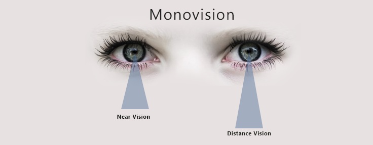 Vision Source Westview: Monovision Contact Lenses in Bunker Hill and ...