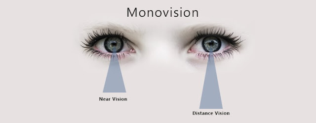 Vision Source Westview: Monovision Contact Lenses in Bunker Hill and ...