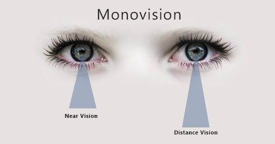 Vision Source Westview: Monovision Contact Lenses in Bunker Hill and ...